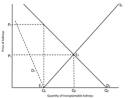 The Price of a Human Kidney - Priceonomics